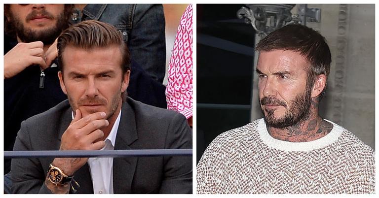 Did David Beckham Get Plastic Surgery?