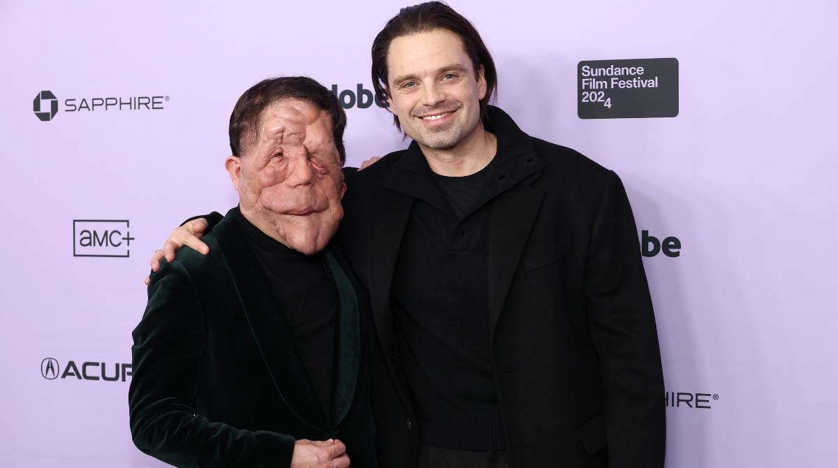 Is Adam Pearson Married? And What Is He up to Now?