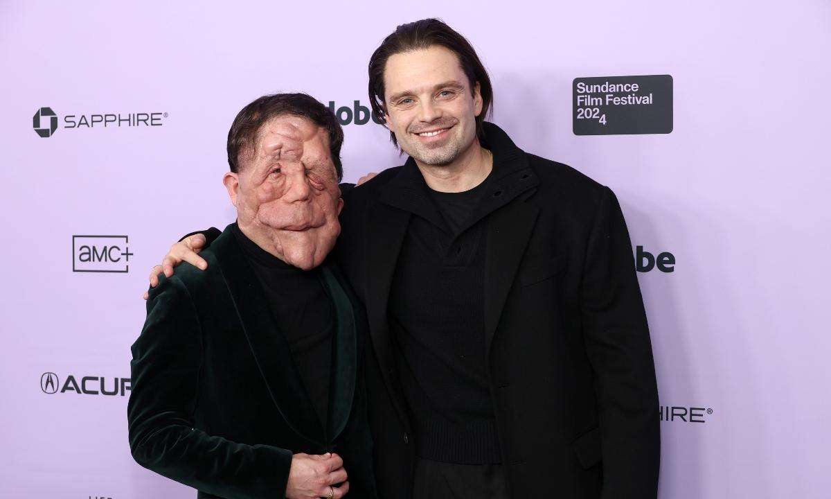 Is Adam Pearson Married? And What Is He up to Now?