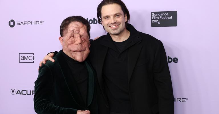 Is Adam Pearson Married? And What Is He up to Now?