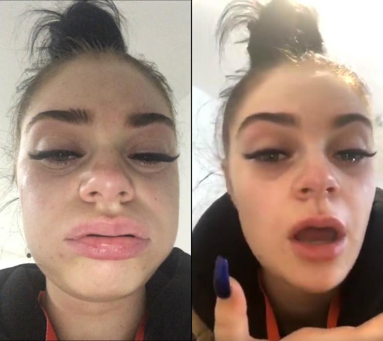 Botched Plastic Surgery – People Who Shouldn't Have Skimped on Getting ...