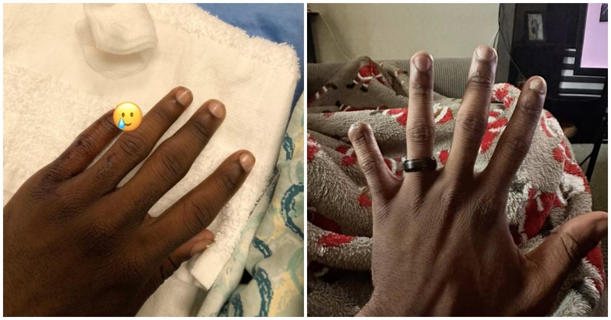 Dog Bites off Amazon Driver's Finger — See the TikTok Video