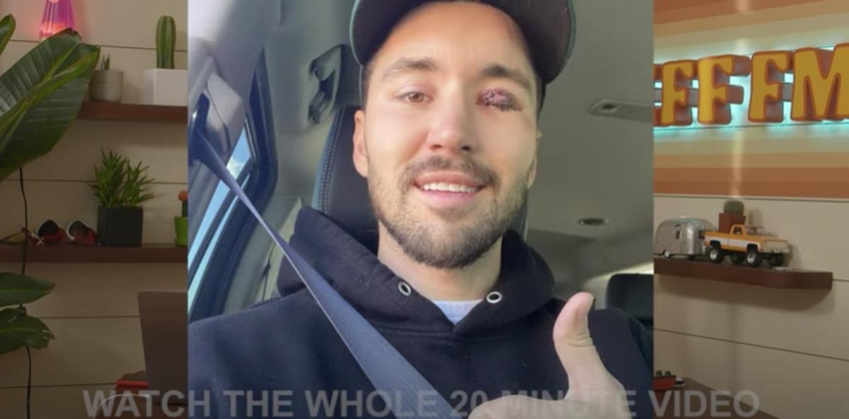 What Happened to Jeff Wittek? Learn More About His Eye Injury