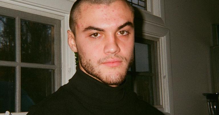 Ethan Dolan's Acne Made Him the Target of Online Bullying — Details