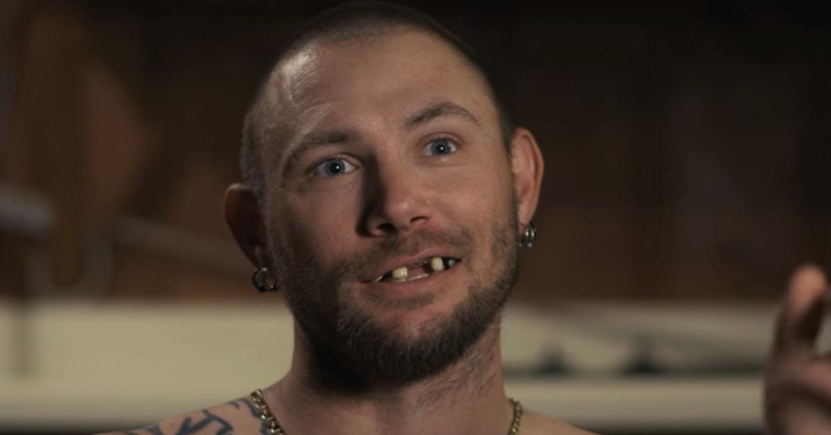 Why Does Meth Ruin Your Teeth? What You Need to Know