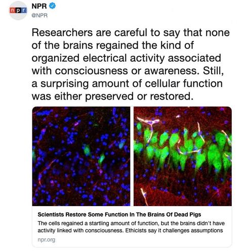 Scientists "Somewhat Revive" Dead Pig Brains — Is This How We Get Zombies?