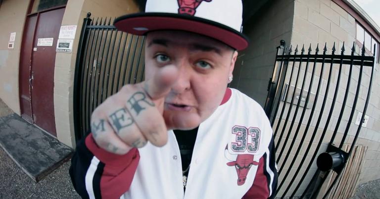 What Happened to Merkules' Face? Everything You Need to Know About the ...