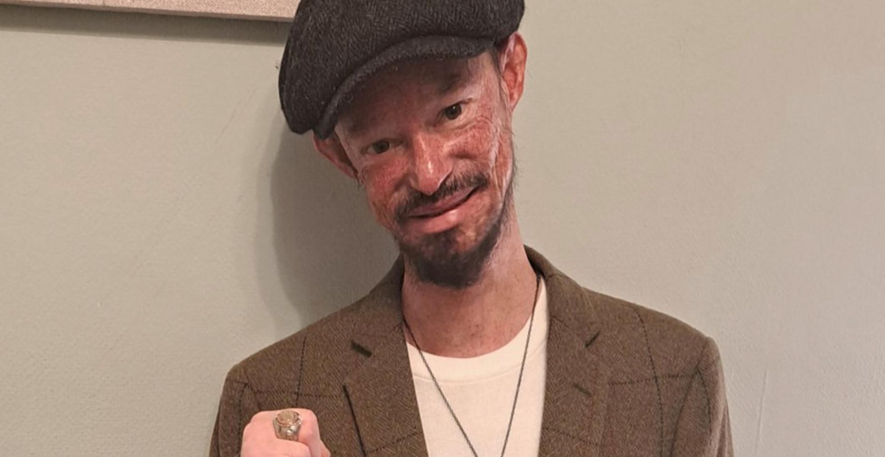 What Was Darren Kent's Cause of Death? Here's What We Know