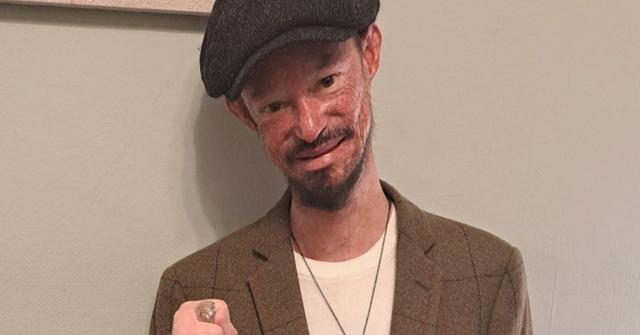 What Was Darren Kent's Cause of Death? Here's What We Know