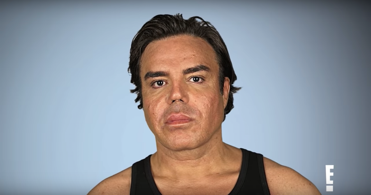 Who Is Lebanese singer Sammy on 'Botched'? He Wants a Fifth Nose Job