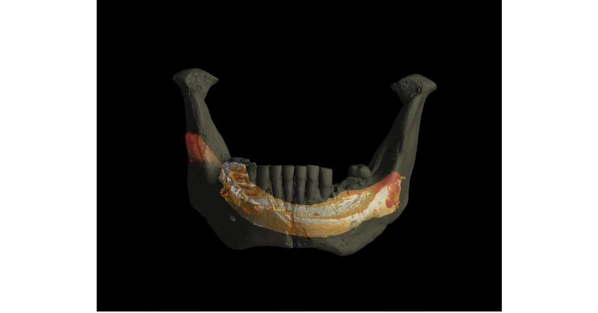 Dentist Finds 1.75 Million Year Old Human Jawbone in Tile Floor