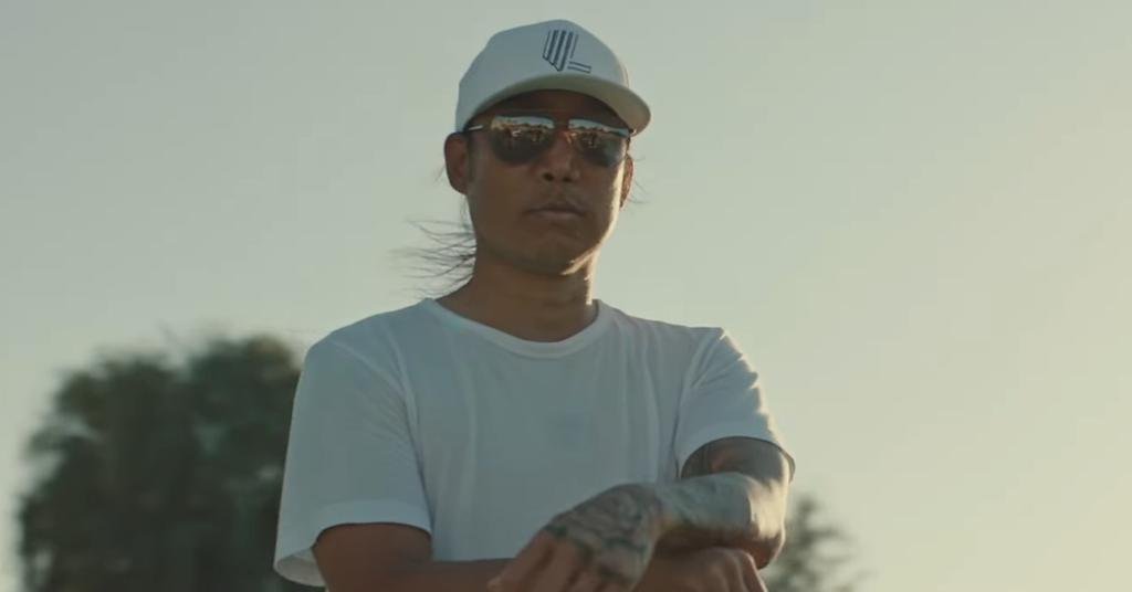 Here's What Happened to Anthony Kim's Face — Injury Update