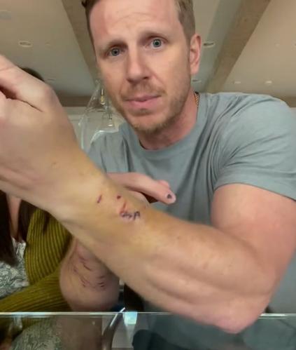 The Sean Lowe Dog Attack Controversy Explained — What Happened?