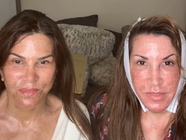 Former Housewives Jac Laurita and Lynne Curtin's Plastic Surgery Update