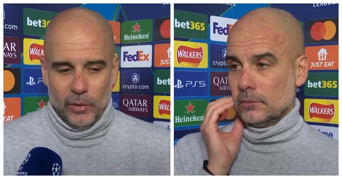Here's What Happened to Pep Guardiola's Face
