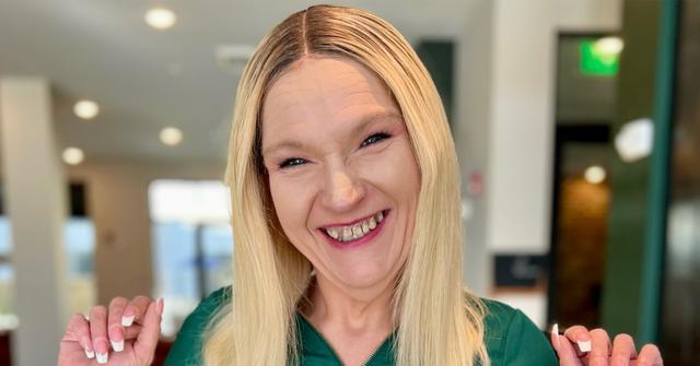 1000-Lb Best Friends Star Vannessa Cross Had Skin Removal Surgery