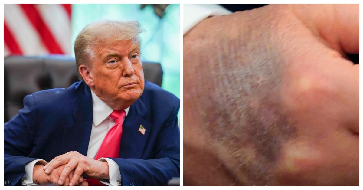 Trump's Hand Sparks Game of Thrones Greyscale Memefest