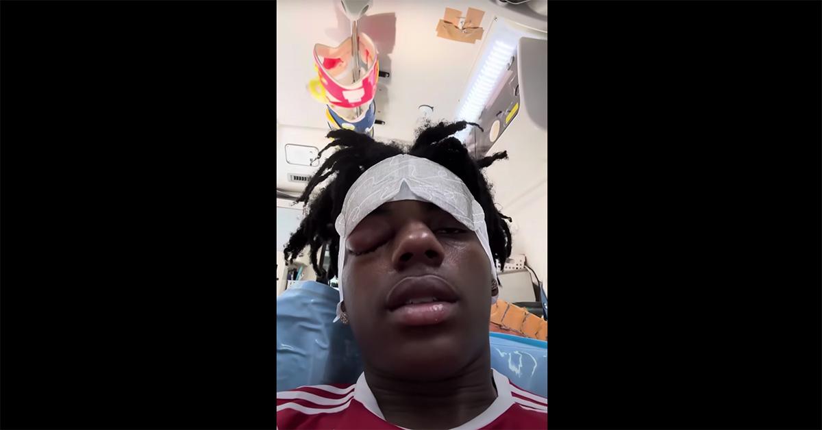 What Happened to YouTube Star IShowSpeed's Eye? Update