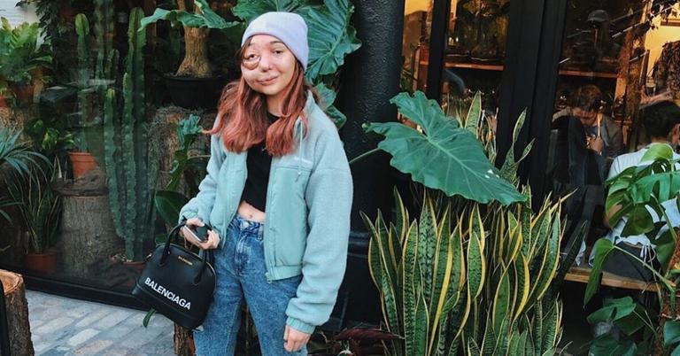 What Happened to Nikki Lilly? The YouTuber Explains Her Medical Condition