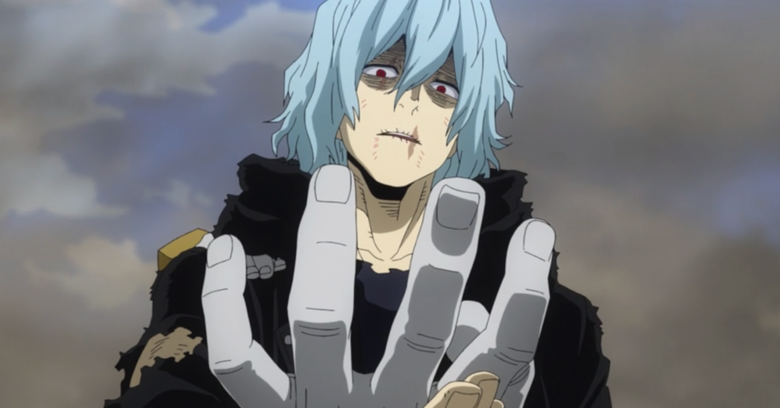 Why Does Shigaraki Itch? Why Does He Have So Many Hands? Details