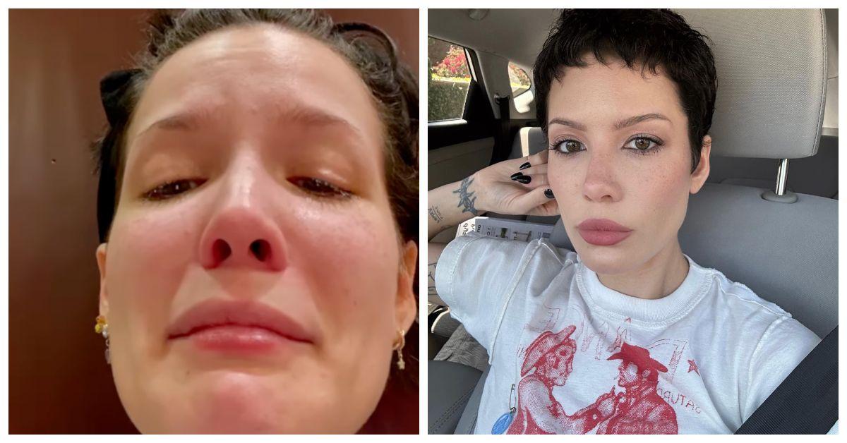 Halsey Shares a Health Update After Being Diagnosed With Two Diseases