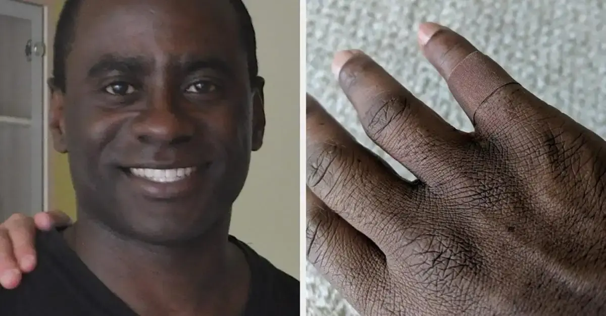 This 45-Year-Old Man's Reaction To Getting A Band-Aid That Matches His ...