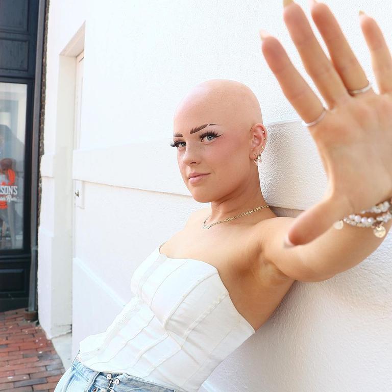 TikTok MUA Emmy Combs Talks Alopecia and Power of Makeup (EXCLUSIVE)