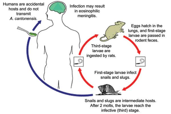 What Is Rat Lungworm Disease, the Disease that Killed This Australian Teen?