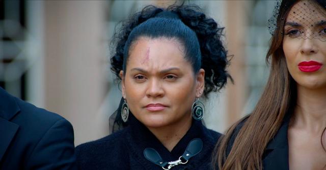 The Traitors US: What Happened to Sandra's Forehead?