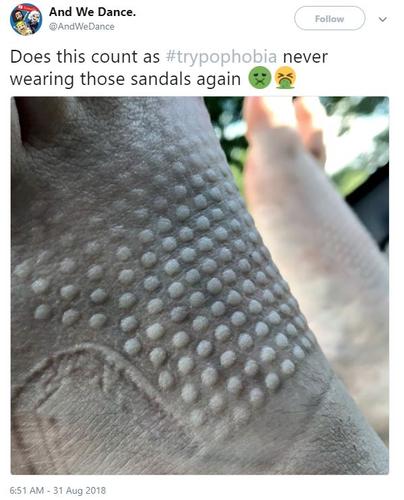 22 Trypophobic Images You Shouldn't Look at for Too Long