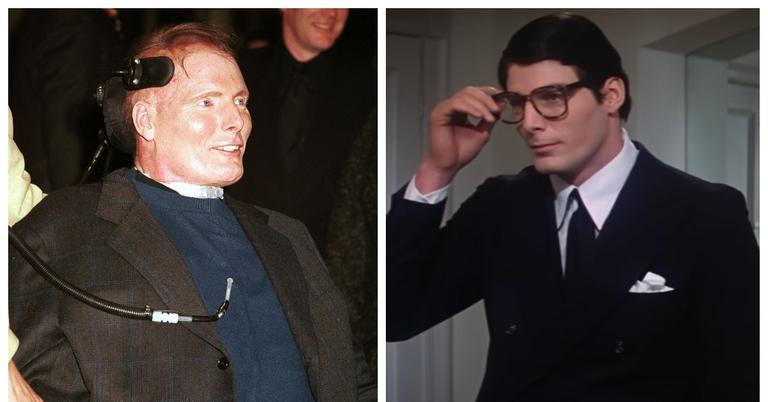 Did Christopher Reeve Wear a Wig? Here's What We Know