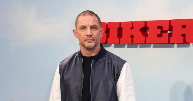 Has Tom Hard Had Hair Transplant Surgery?