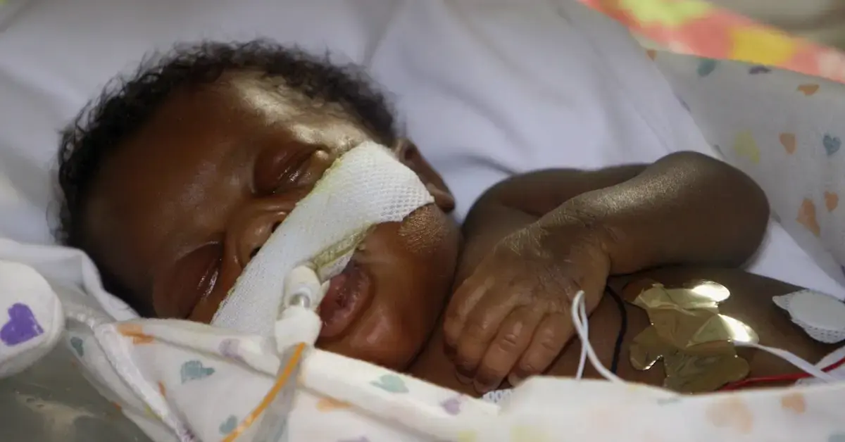 Dawsyn Derrico's Heart Surgery: All the Details About Her Condition