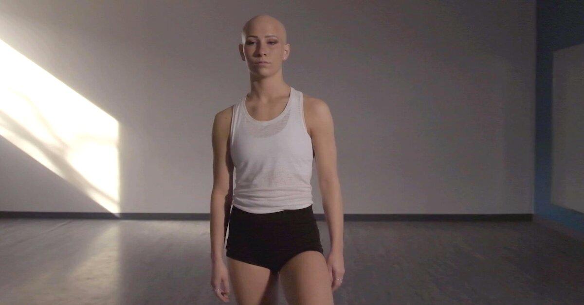 Why Is Madison Jordan Bald? The 'SYTYCD' Contestant's Inspiring Story