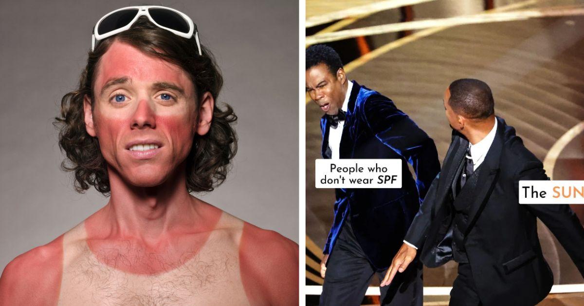 10 Memes That Only People Who Sunburn Will Understand