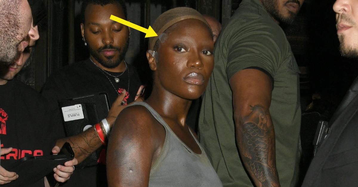 Why Does Doechii Wear Face Tape? Rapper Reveals All – VisionViral.com