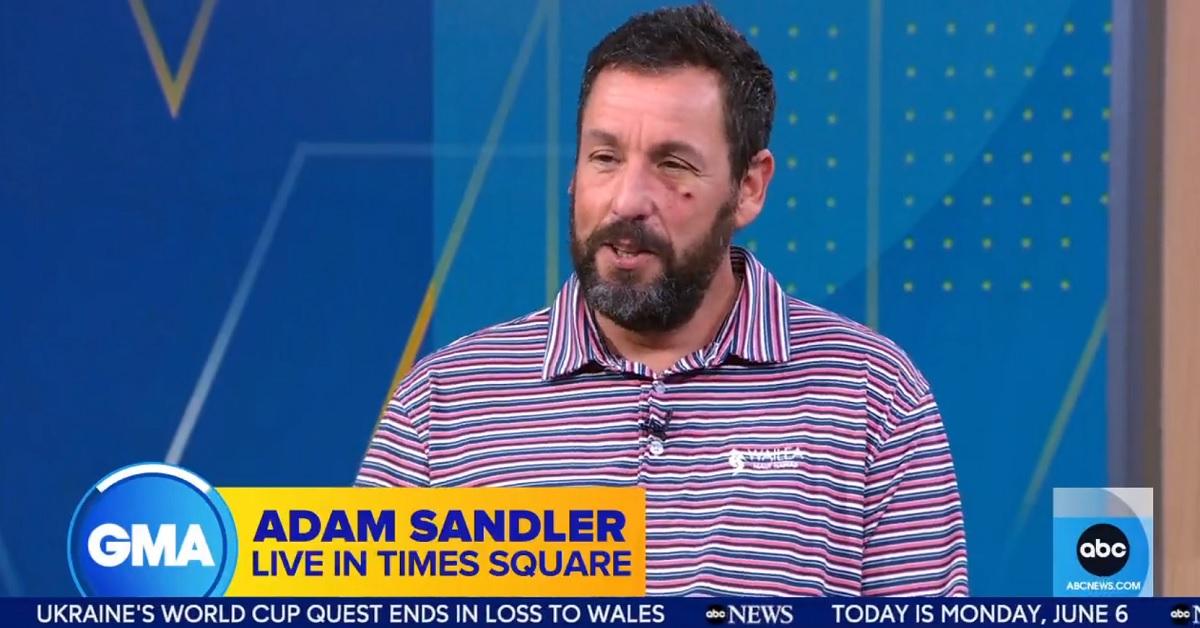 What Happened to Adam Sandler's Eye? He Had a Bed Accident