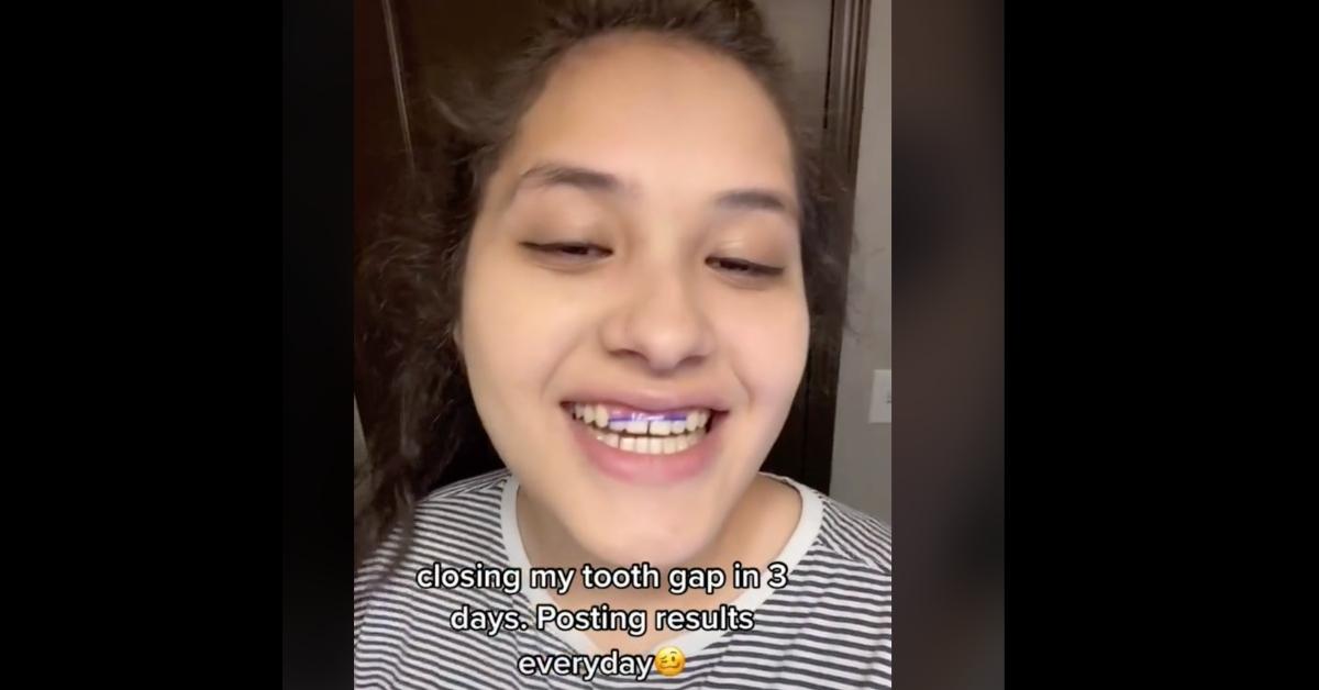 TikTok Dental Hacks — Are They Dangerous? Doctor Weighs In (EXCLUSIVE)