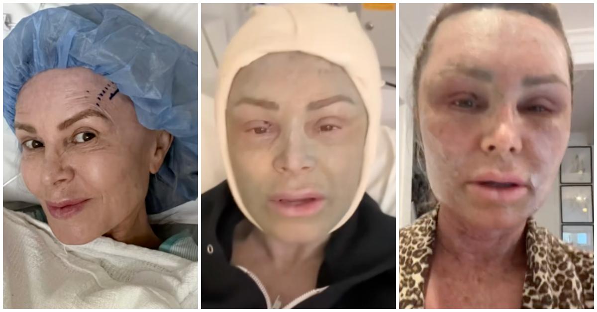 Tamra Judge's Latest Plastic Surgery Has Fans Concerned