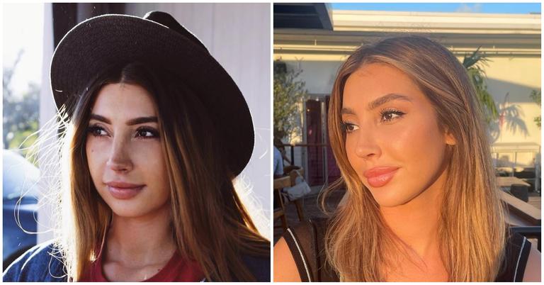 Did Jordana Barnes From 'Siesta Key' Have Plastic Surgery?