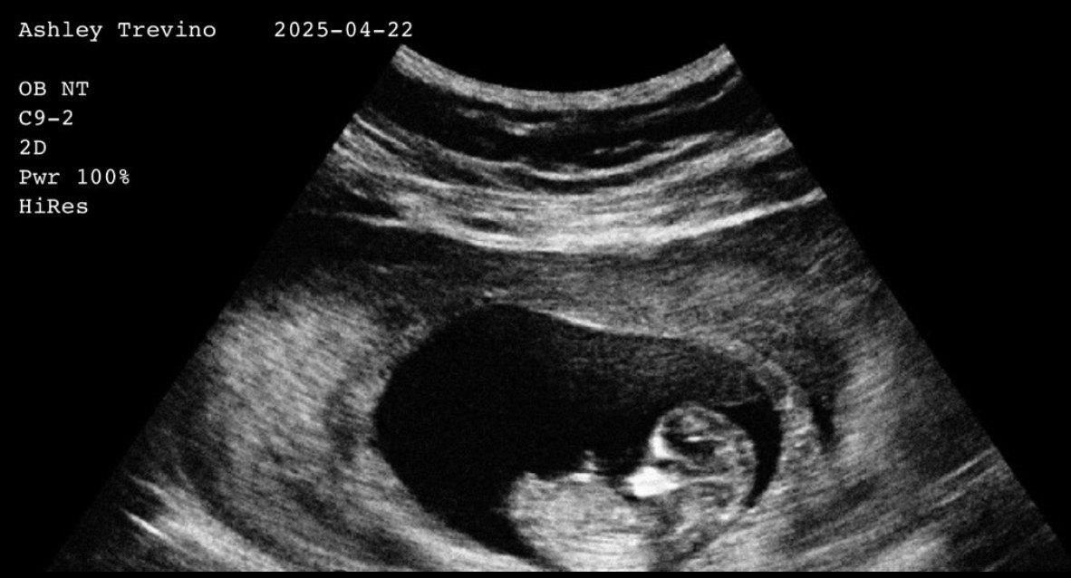 Is Ash Trevino Pregnant? She Dropped Big News on TikTok