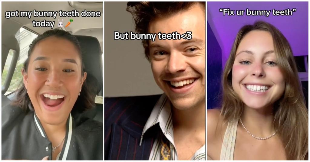 What Are Bunny Teeth? TikTok Can't Decide If They Like Them