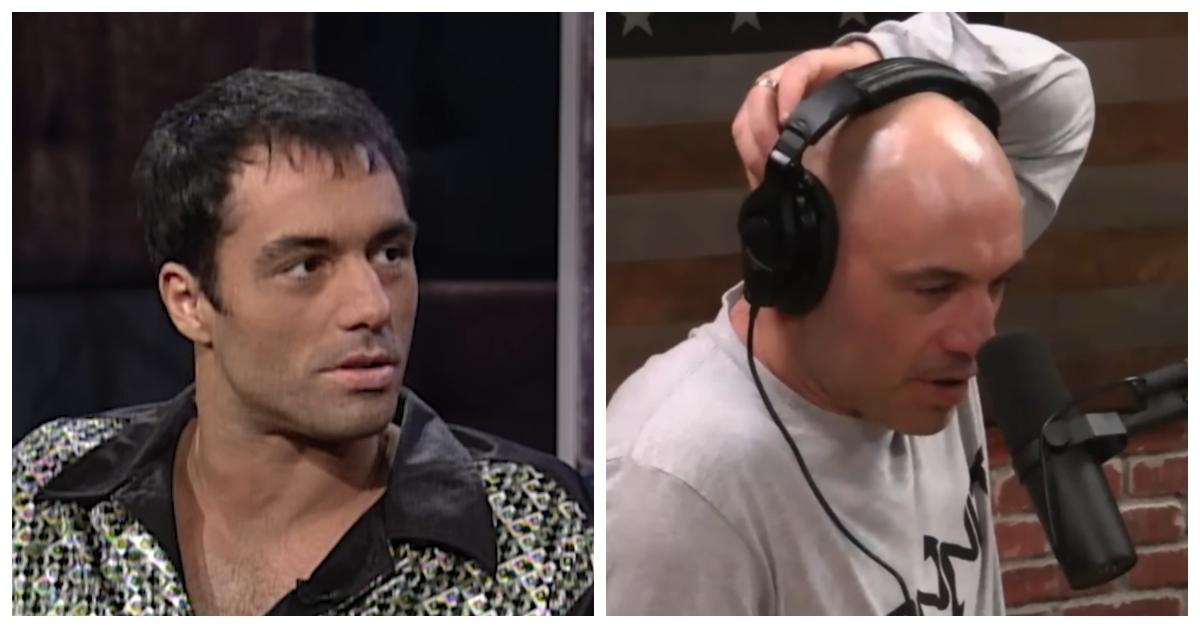 Joe Rogan Talks Failed Hair Transplant