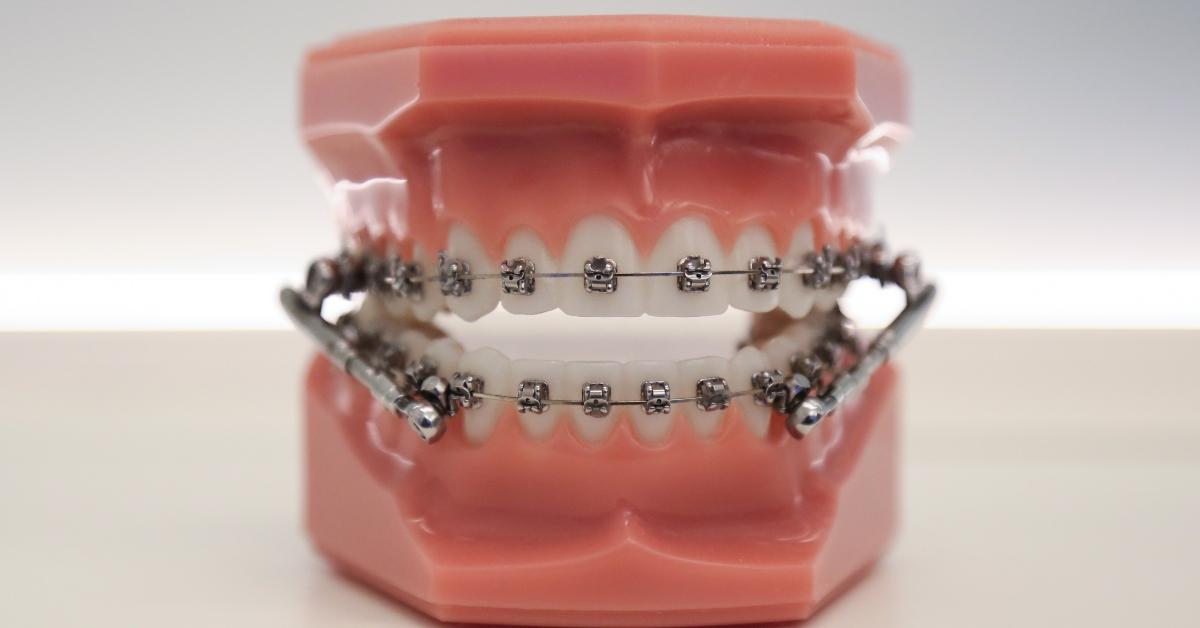 TikTok Dental Hacks — Are They Dangerous? Doctor Weighs In (EXCLUSIVE)