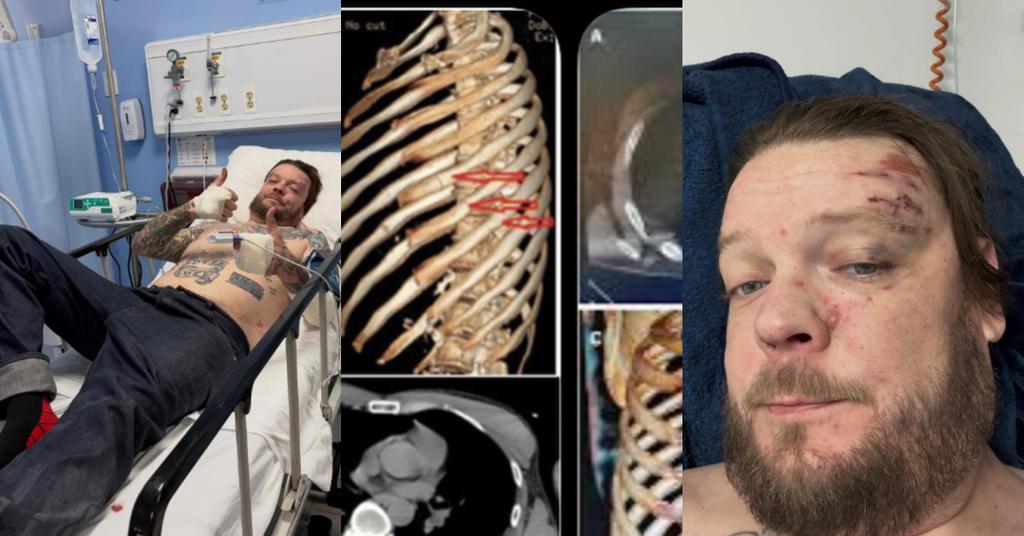 What Happened to Corey Harrison?