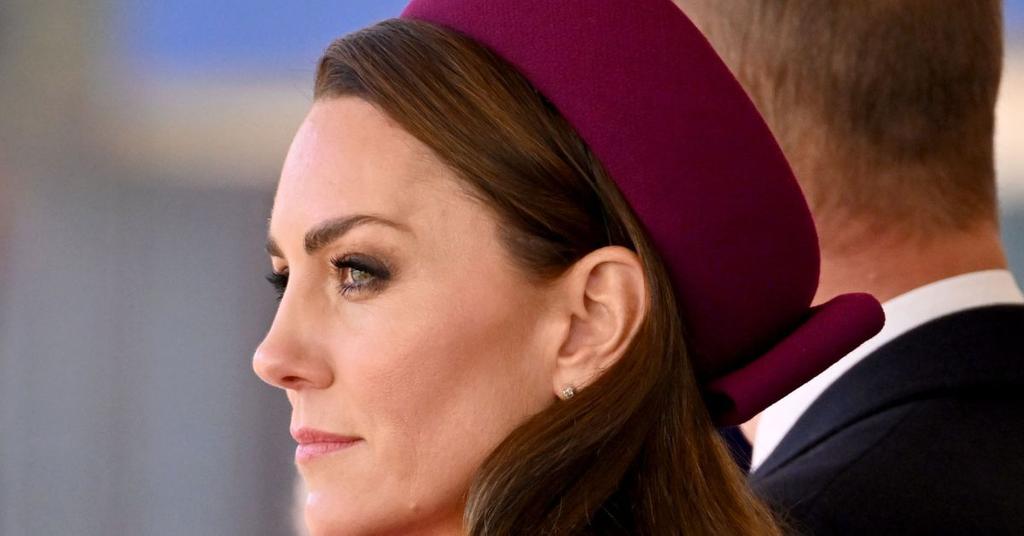 Kate Middleton’s Scar: Why the Royal Wears Her Hair Down