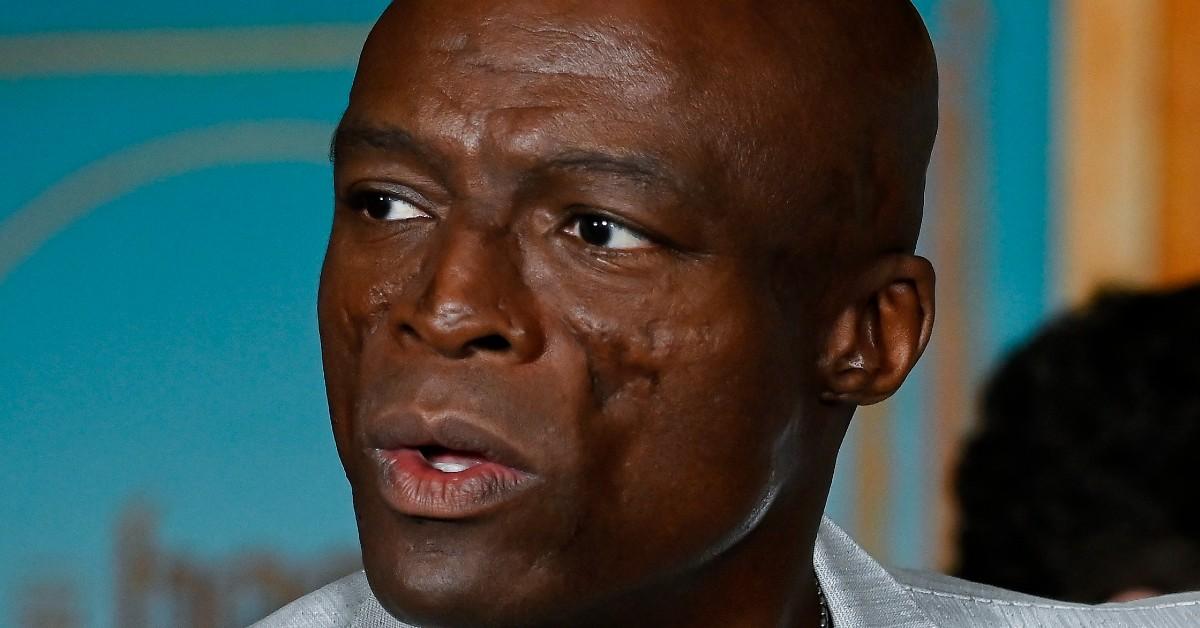 Why Does Seal Have Scars? What Happened to His Face and Hair?