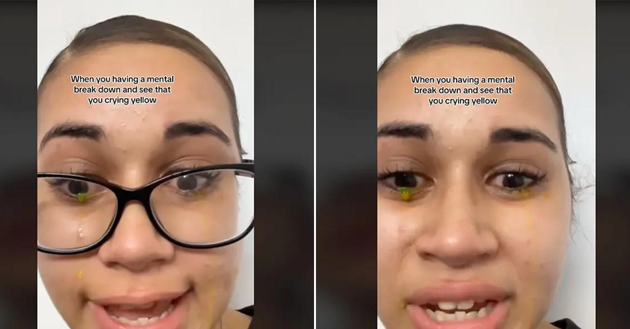 Why Do People Sometimes Cry Yellow Tears? Phenomenon Details