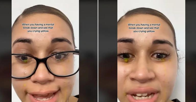 Why Do People Sometimes Cry Yellow Tears? Phenomenon Details