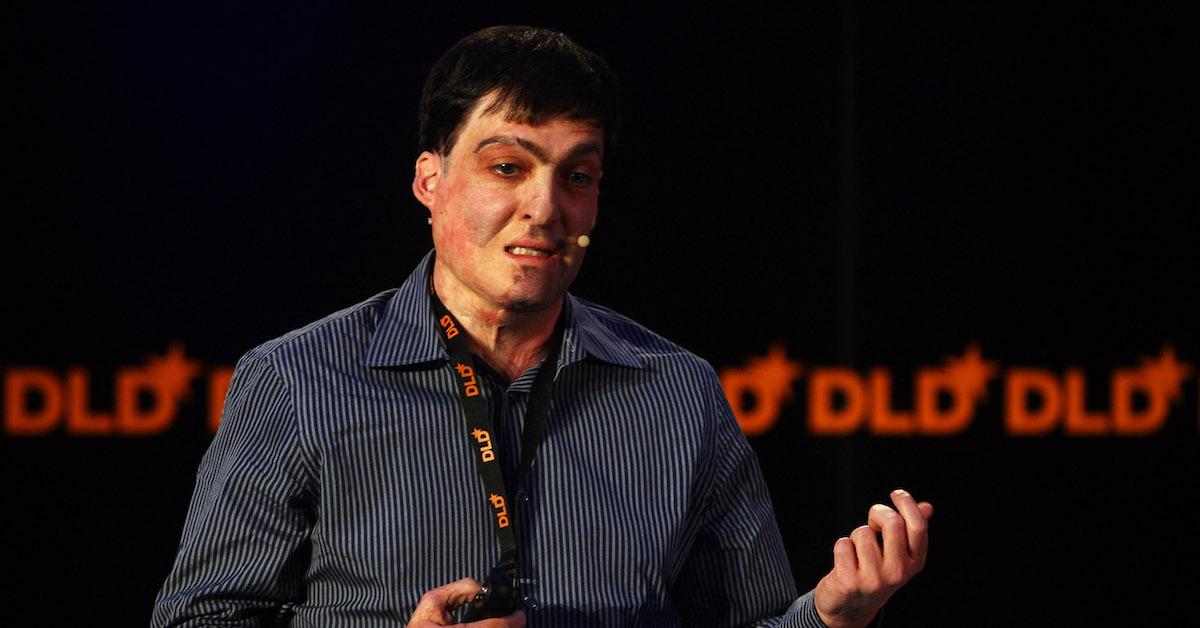 Dan Ariely's Beard — The Accident That Left Him With Half a Beard